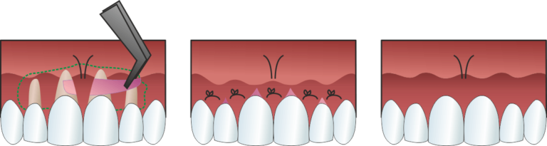 Rezessionsdeckung - Praxis Dr. Behring und Partner