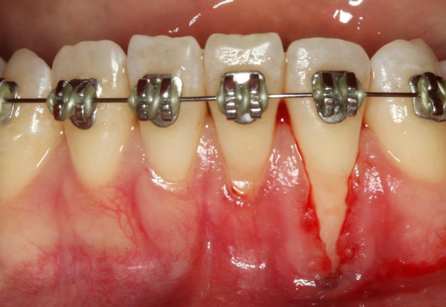 Rezessionsdeckung - Praxis Dr. Behring und Partner