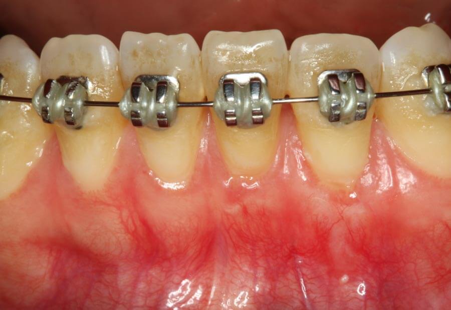 Rezessionsdeckung - Praxis Dr. Behring und Partner