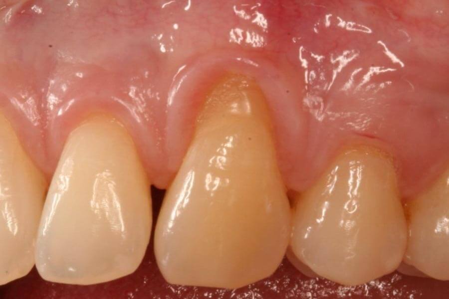 Rezessionsdeckung - Praxis Dr. Behring und Partner