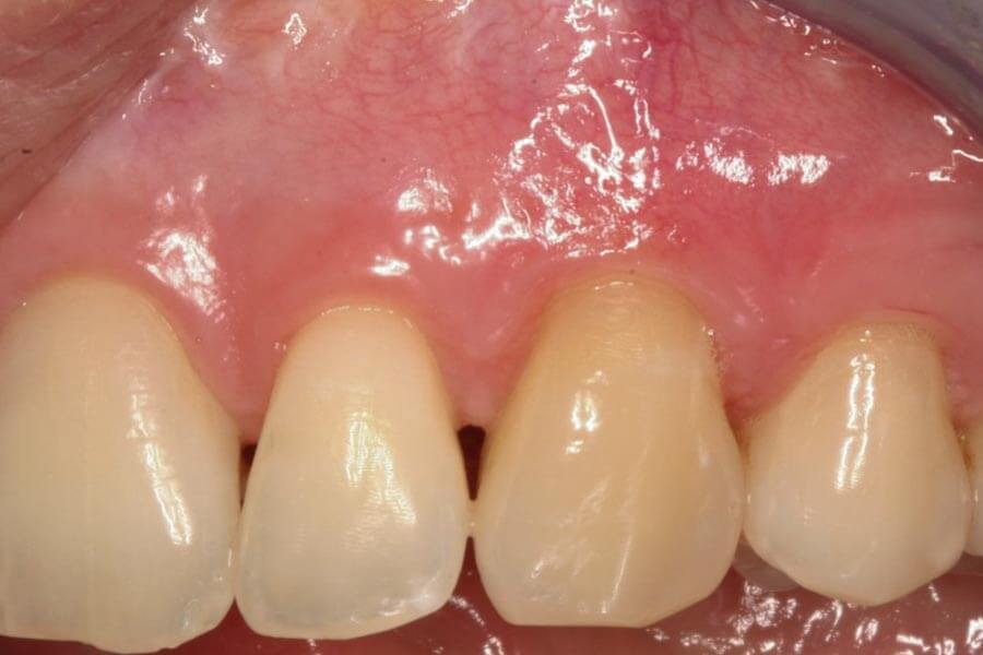 Rezessionsdeckung - Praxis Dr. Behring und Partner